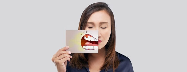 Gum Contouring in Gahanna and Columbus Process - The Smile Method